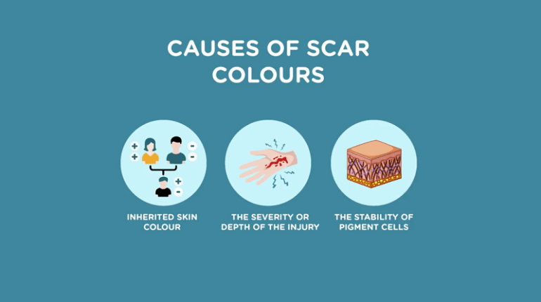 Expert Debunks Common Skin Myths That May Surprise Malaysian Mums