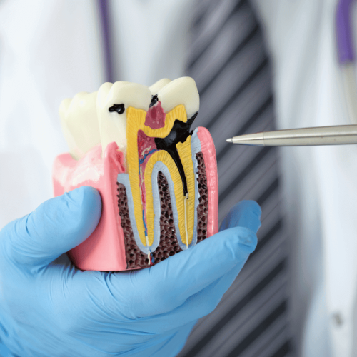 A Parent's Guide to Combating Cavities in Kids | Motherhood Malaysia