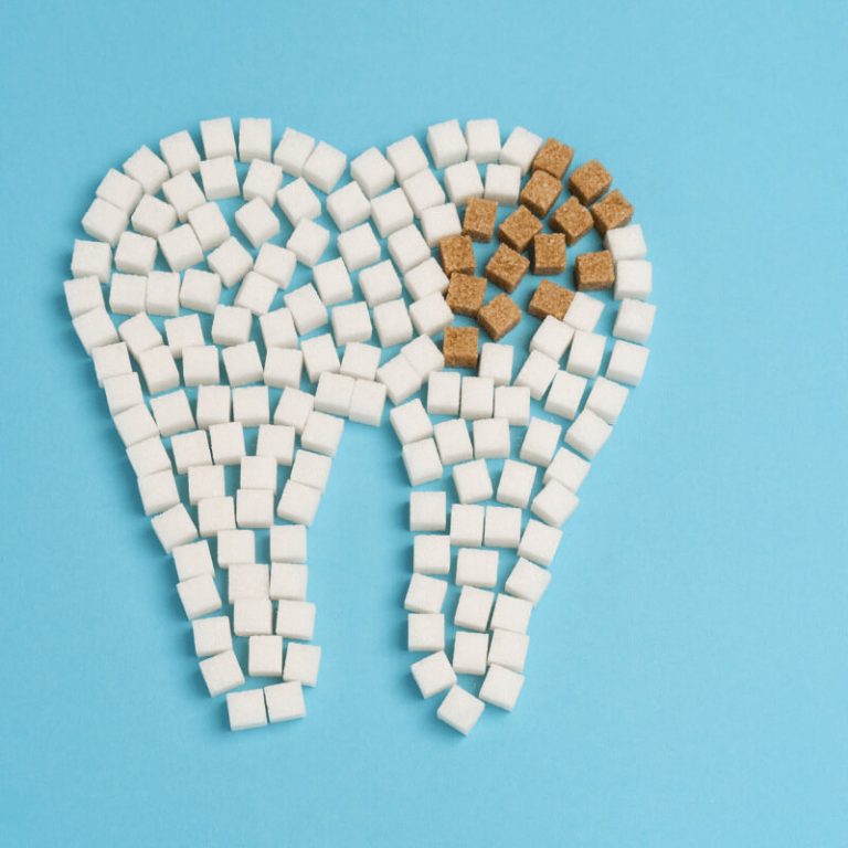 Tooth Decay in Kids: Facts You Need to Chew On | Motherhood Malaysia