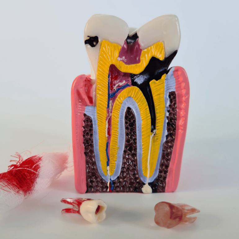 Tooth Decay in Kids: Facts You Need to Chew On | Motherhood Malaysia