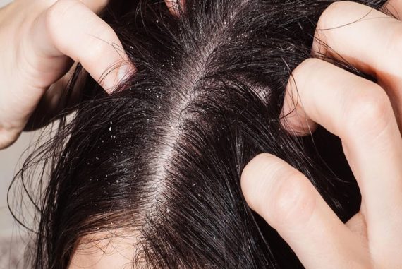 Jom Ganti Simen Gigi Mommy! Tengok 9 Klinik Gigi Di Puncak Alam Ini