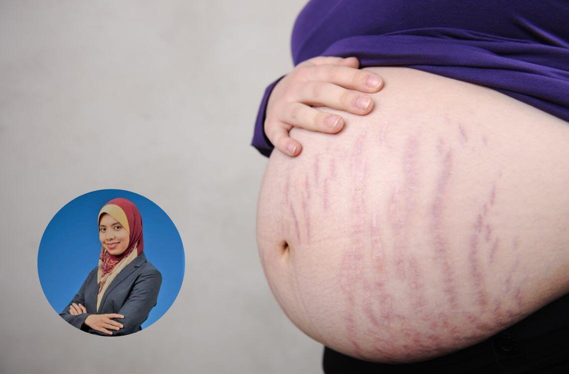 Khas Untuk Bakal Ibu! Penyakit Gatal atau Kulit Yang Sering Menyerang ...