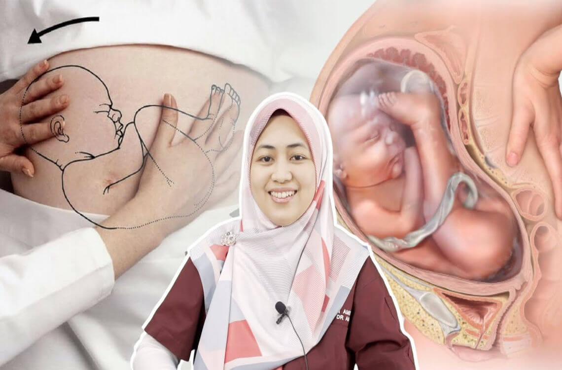 Posisi Tidur Elak Bayi Songsang Guna 4 Teknik Ini (2025)