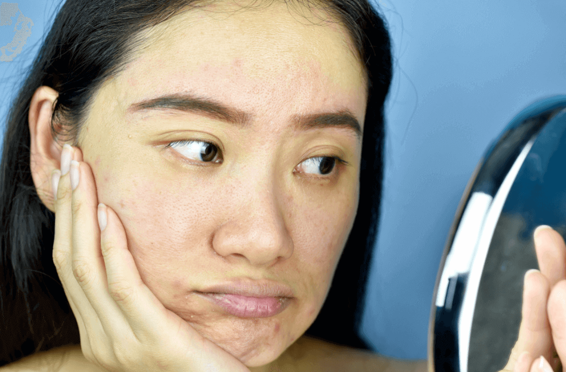 10 Punca Kulit Kusam & 5 Cara Untuk Mendapatkan Kulit Glowing (2026)